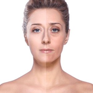 DULL & UNEVEN SKIN TONE - Joyre Medical Aesthetic